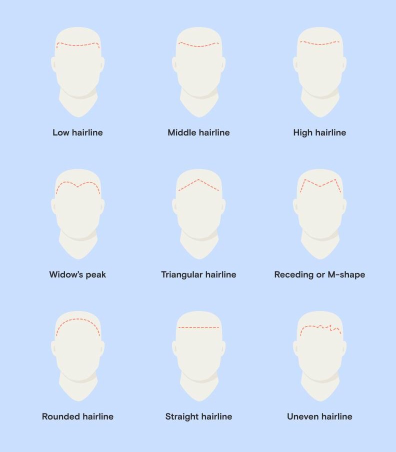 What are the different types of men’s hairlines? And do they change ...